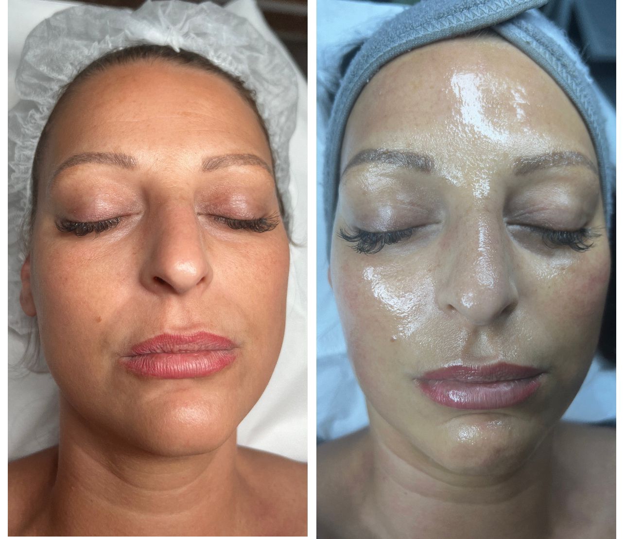 Glass Facial Course - The Online Beauty Courses US